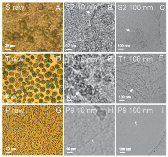 IJMS | Free Full-Text | Assessment of Small Cellular Particles from ...