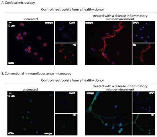 Methods for the Assessment of NET Formation: From Neutrophil Biology to ...