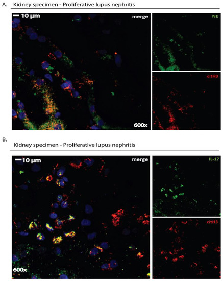 Methods for the Assessment of NET Formation: From Neutrophil Biology to ...
