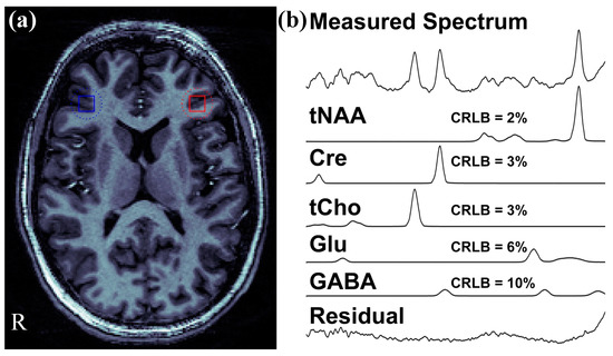 Dorsolateral Prefrontal Cortex Glutamate/Gamma-Aminobutyric Acid (GABA ...