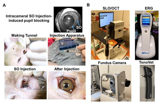 Silicone Oil-Induced Glaucomatous Neurodegeneration in Rhesus Macaques