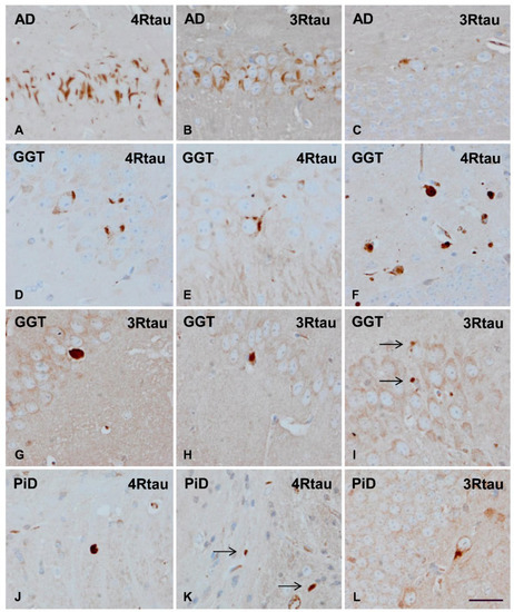Common and Specific Marks of Different Tau Strains Following Intra ...