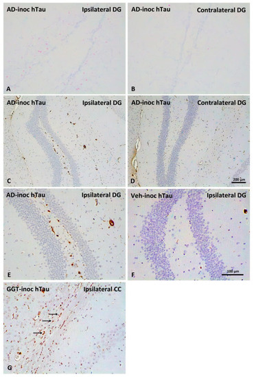 Common and Specific Marks of Different Tau Strains Following Intra ...