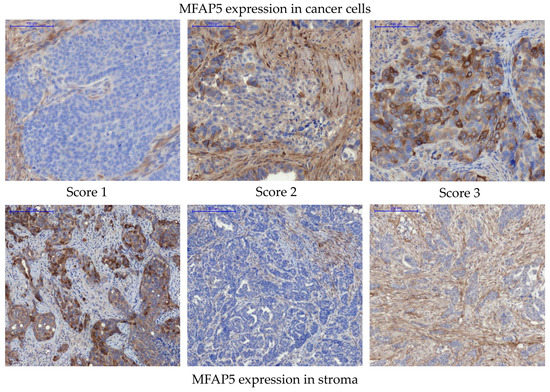 IJMS | Free Full-Text | Microfibril Associated Protein 5 (MFAP5) Is ...