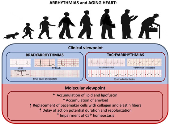 The Aging Heart: A Molecular and Clinical Challenge