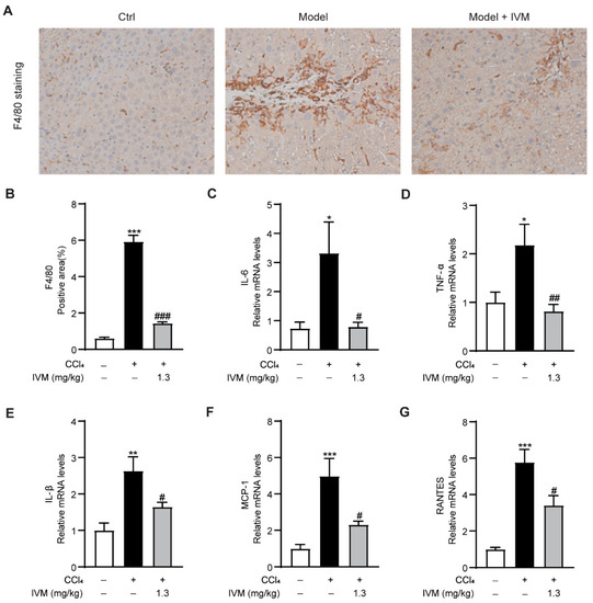 Ivermectin Attenuates CCl4-Induced Liver Fibrosis in Mice by ...