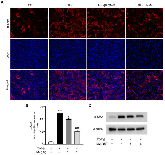 Ivermectin Attenuates CCl4-Induced Liver Fibrosis in Mice by ...