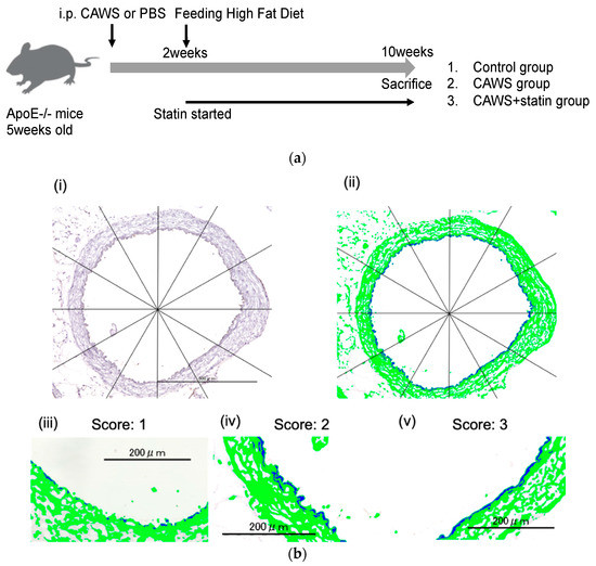 Statins Show Anti-Atherosclerotic Effects by Improving Endothelial Cell ...
