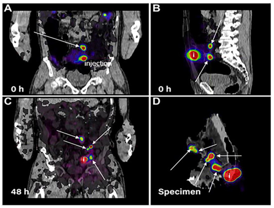 Advances in Imaging of Inflammation, Fibrosis, and Cancer in the ...