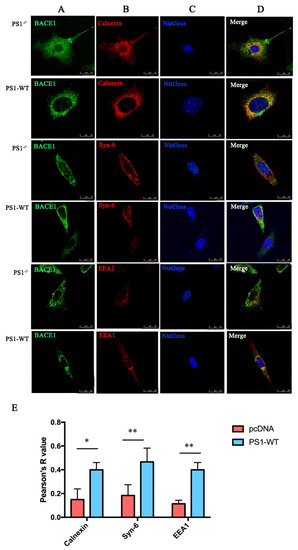 PS1 Affects the Pathology of Alzheimer’s Disease by Regulating BACE1 ...