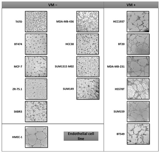 PARP Inhibitor Inhibits the Vasculogenic Mimicry through a NF-κB-PTX3 ...