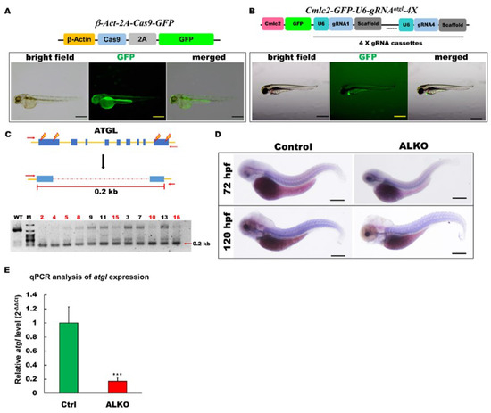 Deficiency of Adipose Triglyceride Lipase Induces Metabolic Syndrome ...