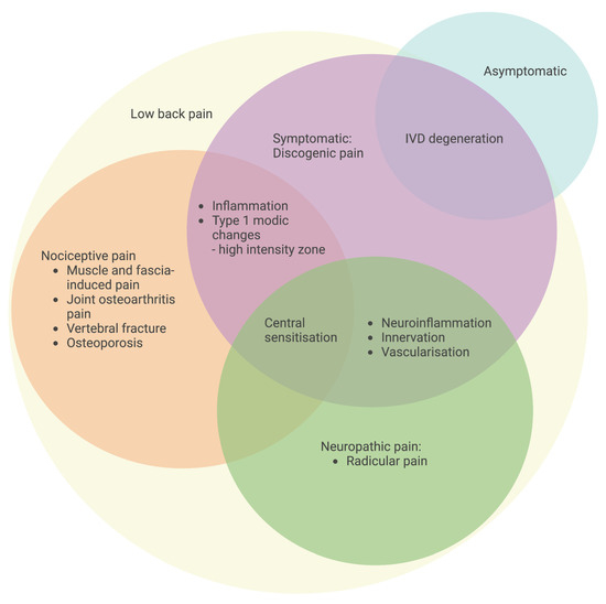Discogenic Low Back Pain: Anatomy, Pathophysiology and Treatments of ...