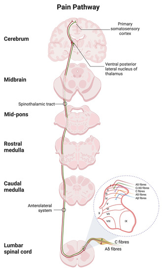 Discogenic Low Back Pain: Anatomy, Pathophysiology and Treatments of ...