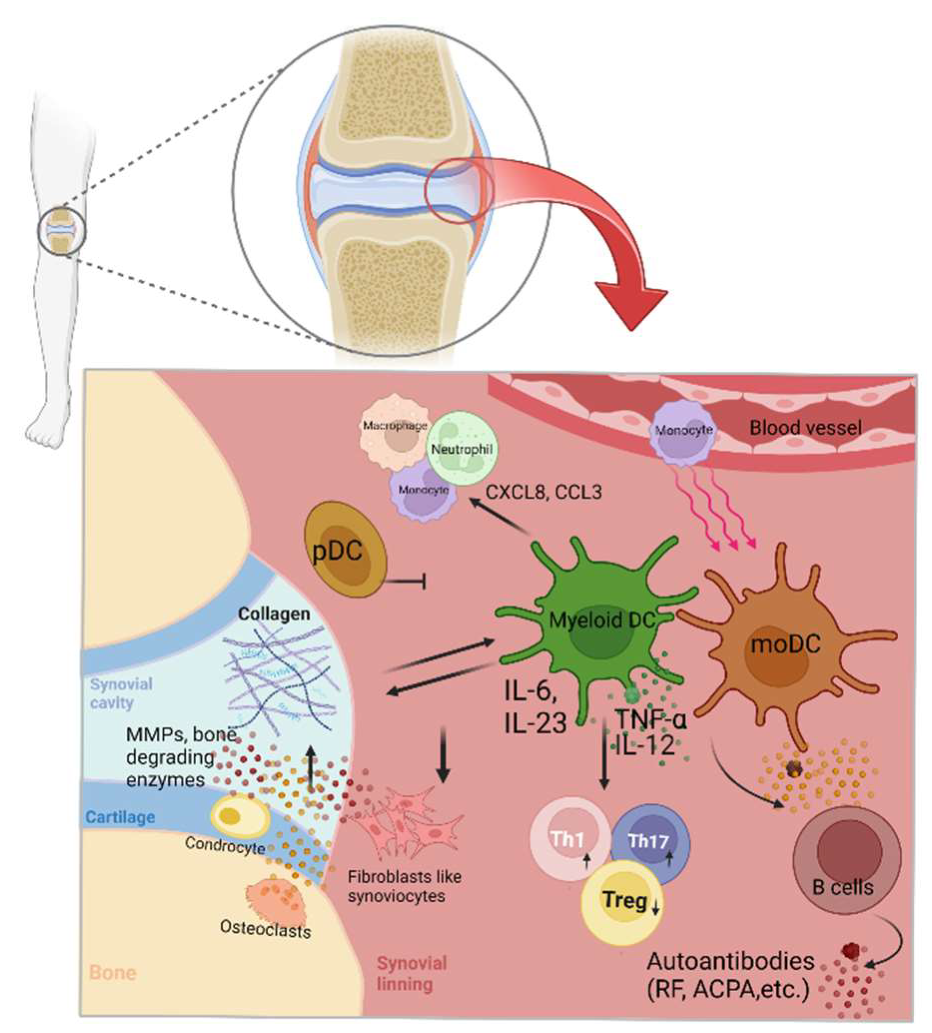 Rheumatoid Arthritis Treatment Natural Rheumatoid Arthritis Treatment Natural