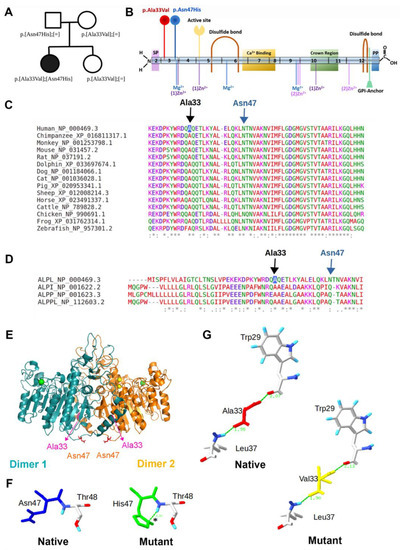 Childhood Hypophosphatasia Associated with a Novel Biallelic ALPL ...
