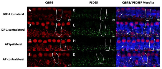 Prevention of Noise-Induced Hearing Loss In Vivo: Continuous ...