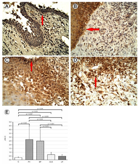 Expression of the Selected Proteins of JAK/STAT Signaling Pathway in ...
