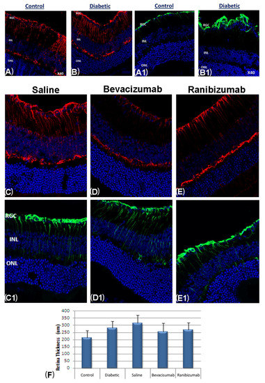 Characterization of Diabetic Retinopathy in Two Mouse Models and ...