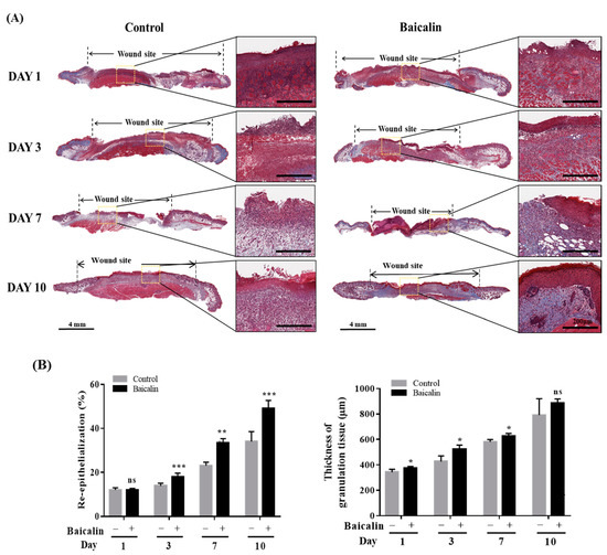 Effect of Baicalin on Wound Healing in a Mouse Model of Pressure Ulcers