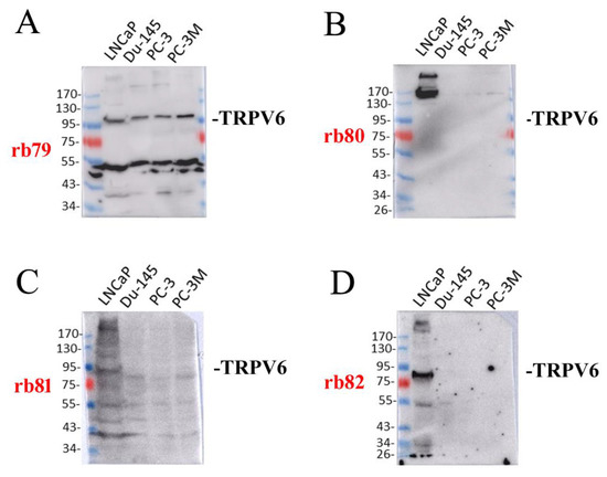 A Novel Anti-TRPV6 Antibody and Its Application in Cancer Diagnosis In ...