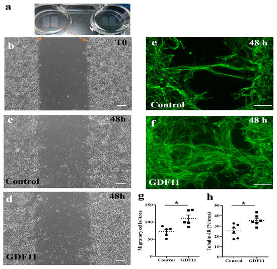 IJMS | Free Full-Text | Multifaceted Benefits of GDF11 Treatment in ...