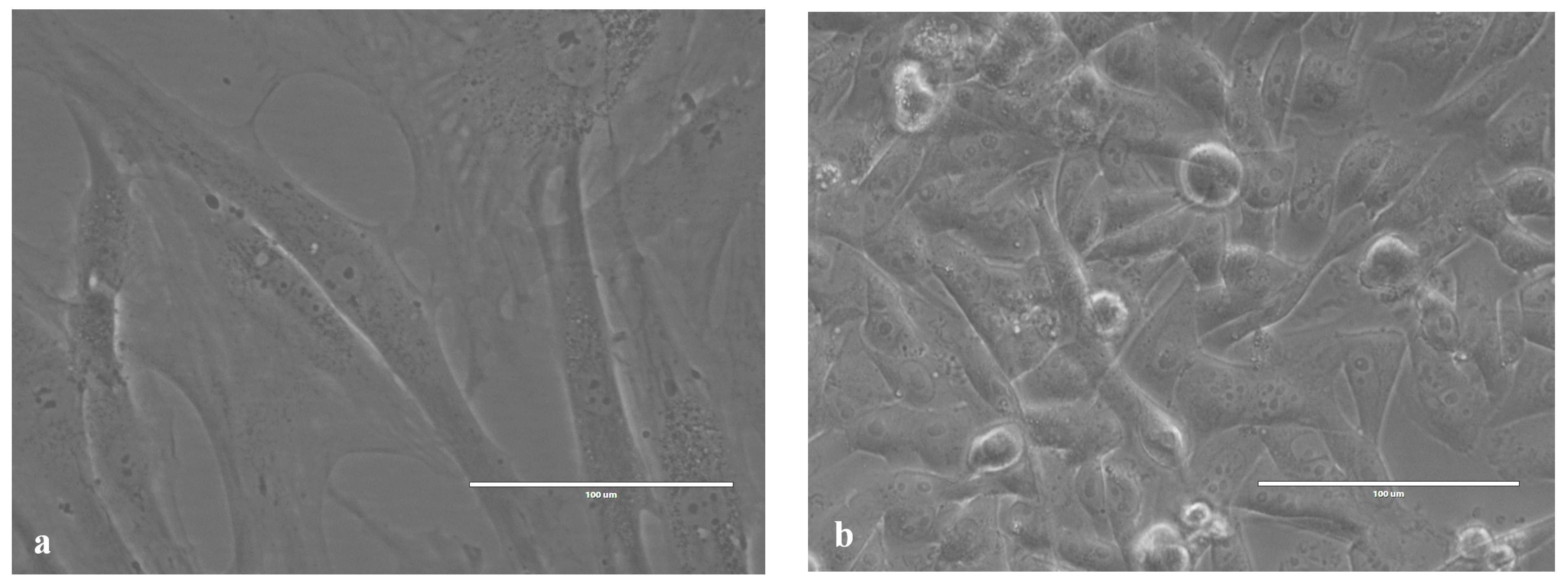A Simple Protocol for Sample Preparation for Scanning Electron ...