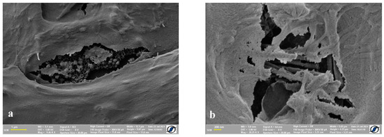 A Simple Protocol for Sample Preparation for Scanning Electron ...