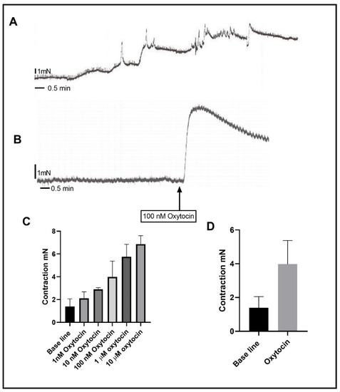 Smooth Muscle Contraction Graph
