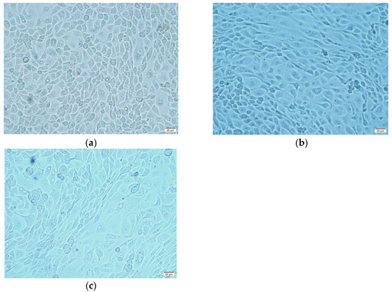 Persistence Infection of TGEV Promotes Enterococcus faecalis Infection ...
