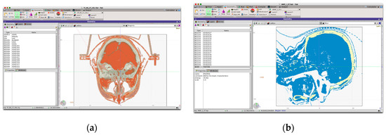 IJMS | Free Full-Text | Dosimetry Effects Due to the Presence of Fe ...
