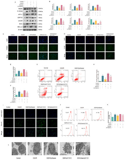 Geraniol-Mediated Suppression of Endoplasmic Reticulum Stress Protects against Cerebral Ischemia ...