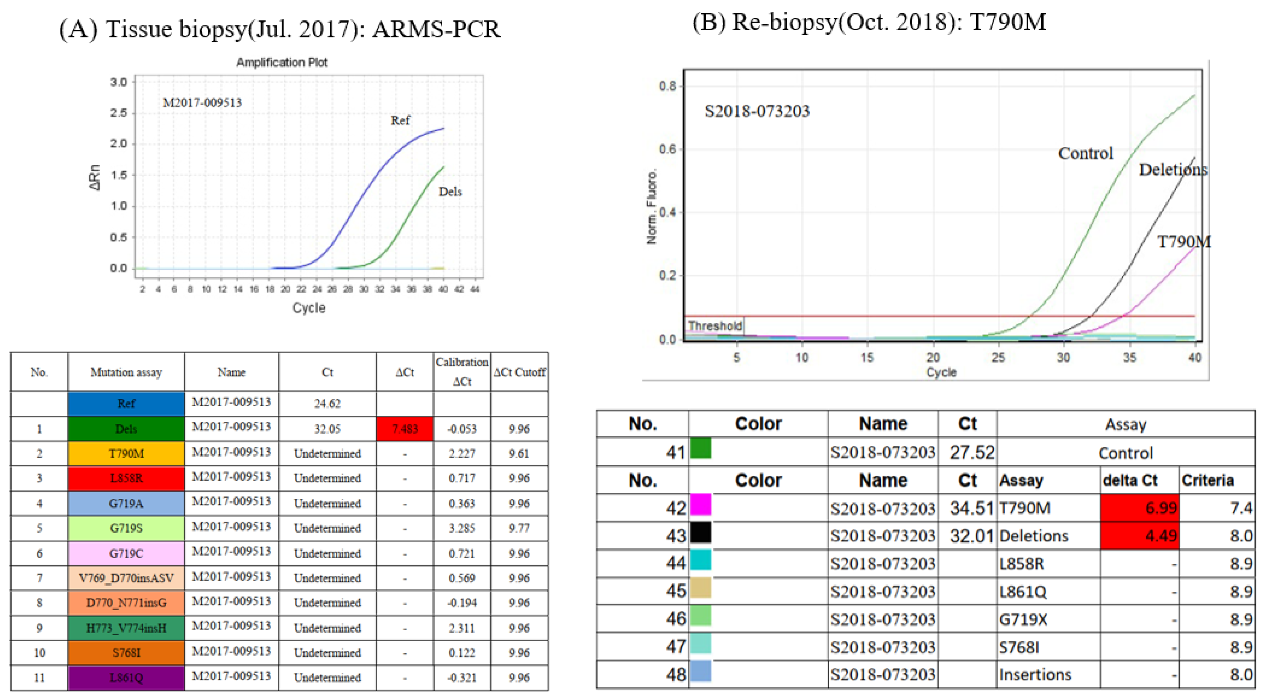 Response to Brigatinib Targeted Therapy in Non-Small Cell Lung Cancer ...