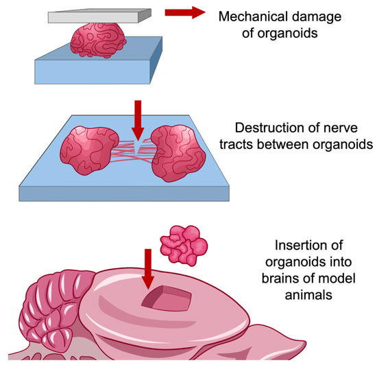Modeling of Neurodegenerative Diseases: ‘Step by Step’ and ‘Network ...