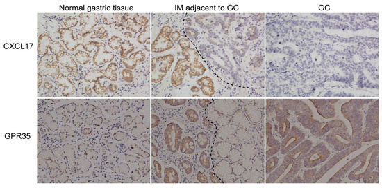 Involvement of CXCL17 and GPR35 in Gastric Cancer Initiation and ...