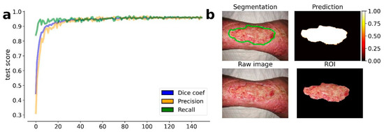 Effectiveness of Semi-Supervised Active Learning in Automated Wound ...