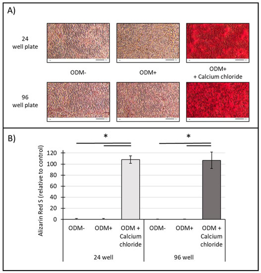 Optimization of the Alizarin Red S Assay by Enhancing Mineralization of ...