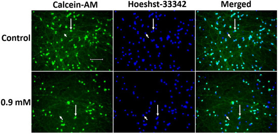 IJMS | Free Full-Text | LUHMES Cells: Phenotype Refinement and ...