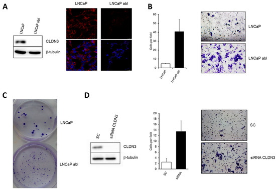 Claudin-3 Loss of Expression Is a Prognostic Marker in Castration ...