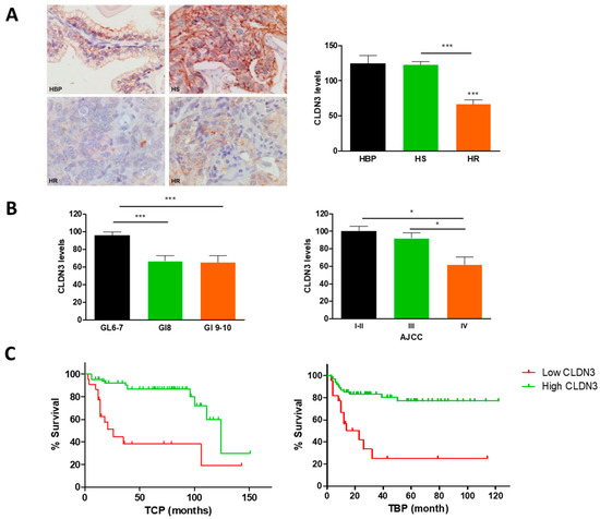 Claudin-3 Loss of Expression Is a Prognostic Marker in Castration ...