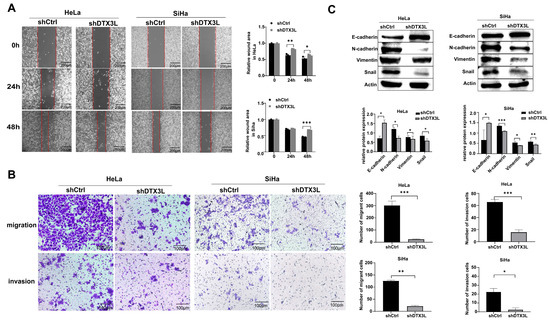 Silencing DTX3L Inhibits the Progression of Cervical Carcinoma by ...