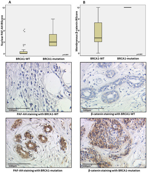 PLA2G7/PAF-AH as Potential Negative Regulator of the Wnt Signaling ...