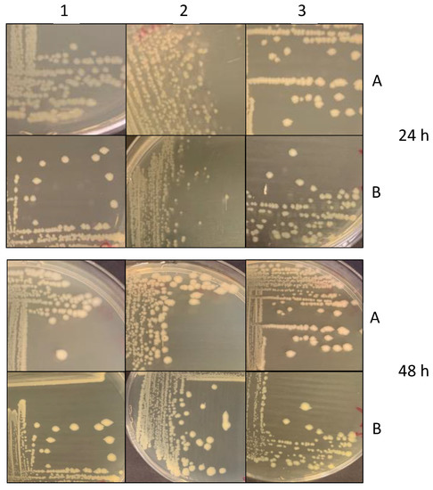 The Prolonged Treatment of Salmonella enterica Strains with Human Serum ...