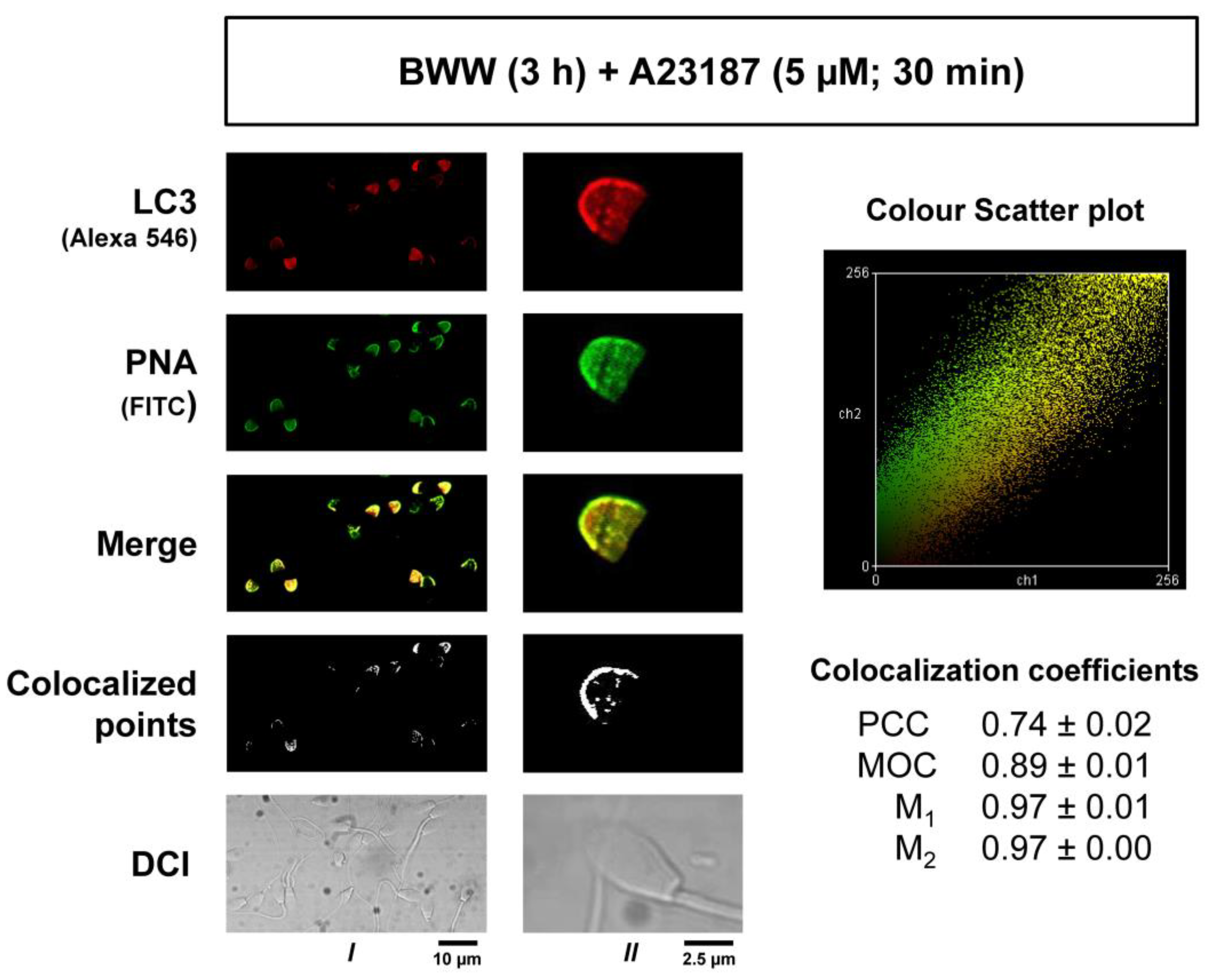 The Autophagy Marker LC3 Is Processed during the Sperm Capacitation and ...