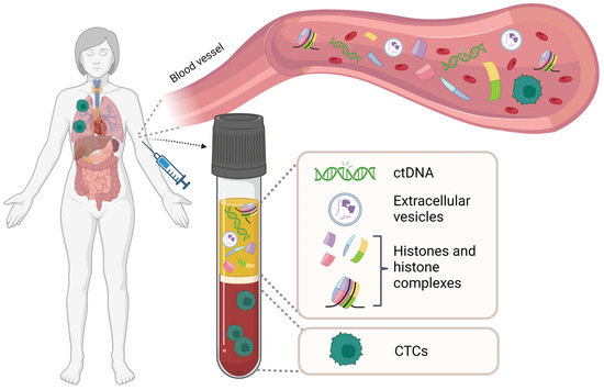 Circulating Histones to Detect and Monitor the Progression of Cancer