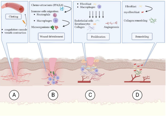 Biofilms in Chronic Wound Infections: Innovative Antimicrobial Approaches Using the In Vitro ...