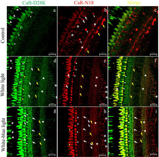 Potential Neuroprotective Role of Calretinin-N18 and Calbindin-D28k in ...