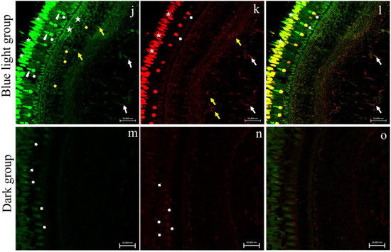 Potential Neuroprotective Role of Calretinin-N18 and Calbindin-D28k in ...