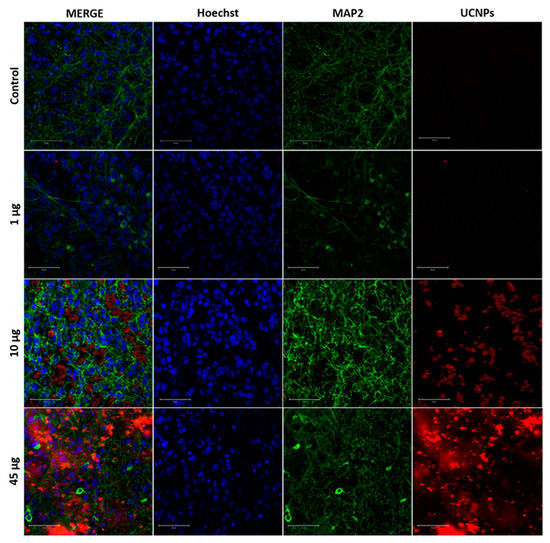 Upconverting Nanoparticles as a New Bio-Imaging Strategy—Investigating ...