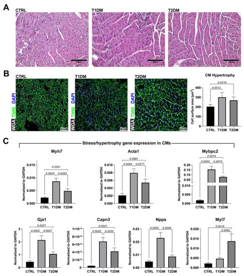 Streptozotocin-Induced Type 1 and 2 Diabetes Mellitus Mouse Models Show ...
